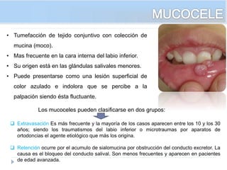 Patologias de la cavidad bucal Dr. Fonseca | PPTX