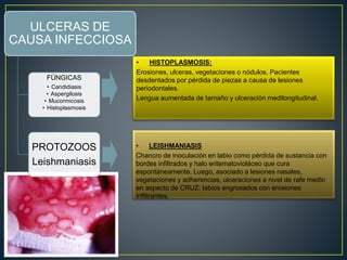 Patologias de la cavidad bucal y glandulas salibales Dr. Fonseca | PPT