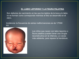 Patologias de la cavidad bucal y glandulas salibales Dr. Fonseca | PPTX