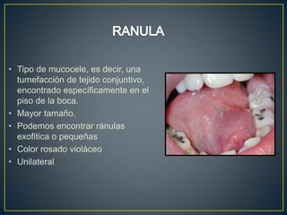 Patologias de la cavidad bucal y glandulas salibales Dr. Fonseca | PPT
