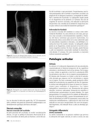 Patologias de la mano | PDF