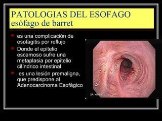 Patologias del aparato digestivo 1 | PPT