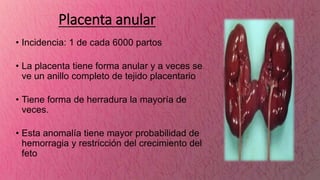 Patologias de la placenta.pptxmmmmmmmmmmmm | PPTX