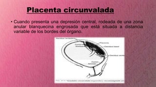 Patologias de la placenta.pptxmmmmmmmmmmmm | PPTX