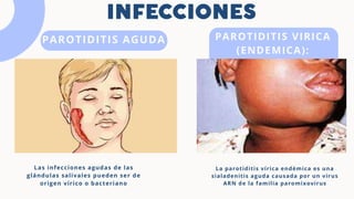 PATOLOGIAS DE LAS GLANDULAS SALIVALES-SHA 2.pptx
