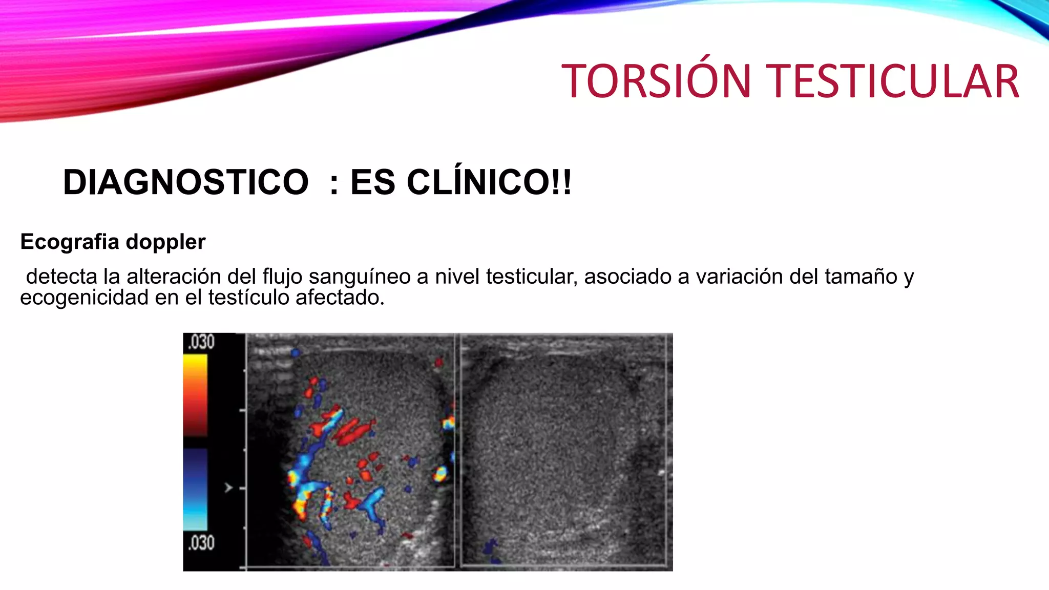 Patologías del canal inguinal