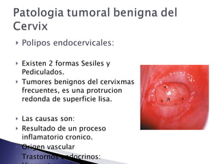 Patologias del cervix | PPT