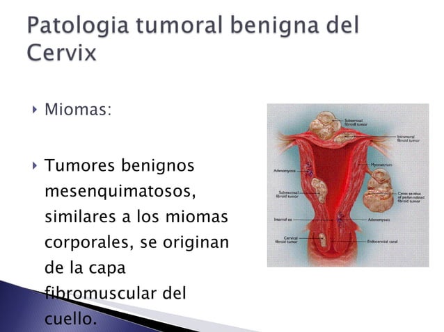 ¿Qué Es Y Cuál Es La Función Del Cervix? – LRPLVP