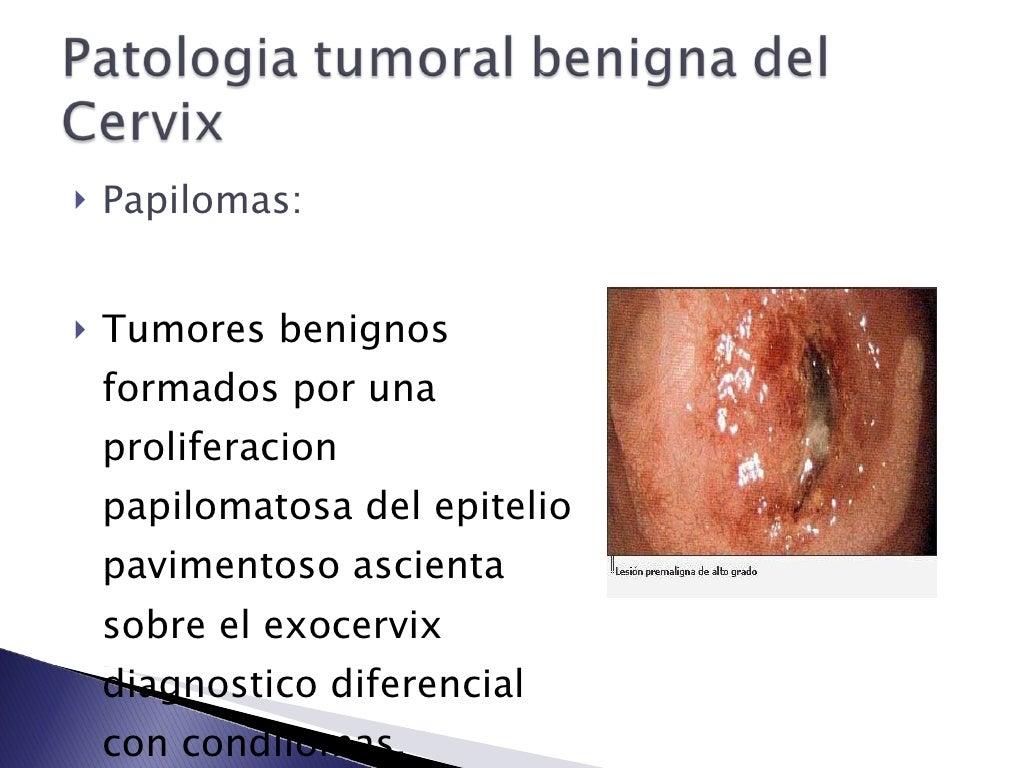 Patologias del cervix