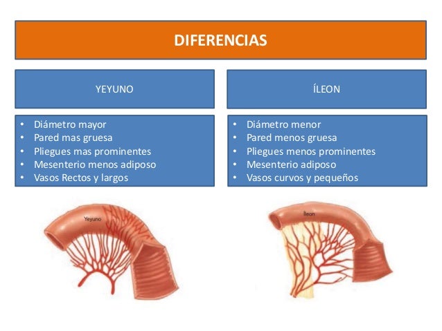 CIRUGÍA: Patologias del intestino delgado