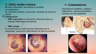 Patologias del oido.pptx
