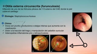 Patologias del oido.pptx