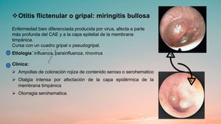 Patologias del oido.pptx