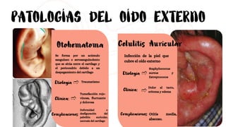 PATOLOGIAS DEL OIDO .pdf. para descargar | PDF