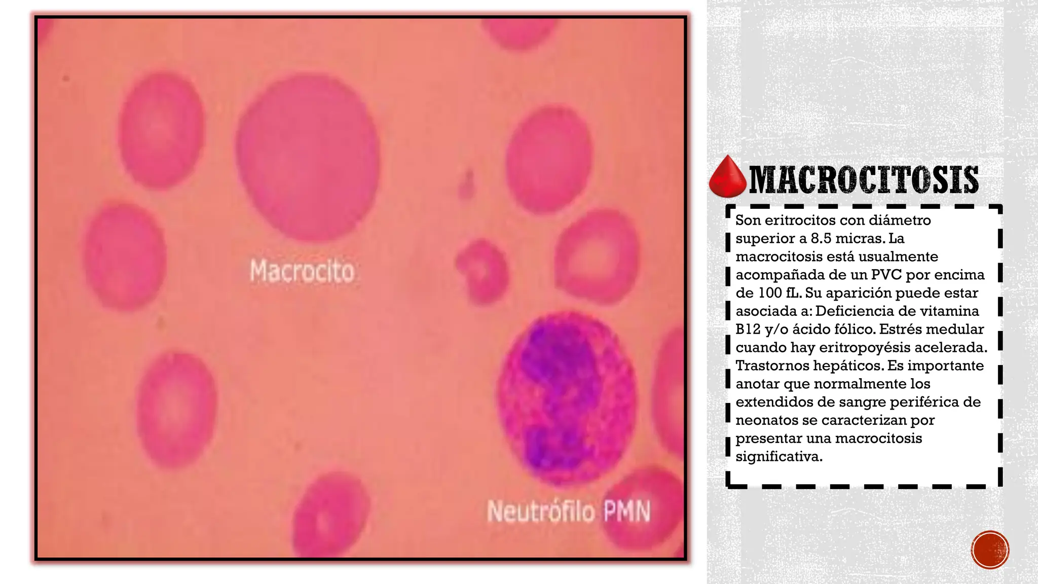 Patologías de los eritrocitos-Histologia.pptx | PDF