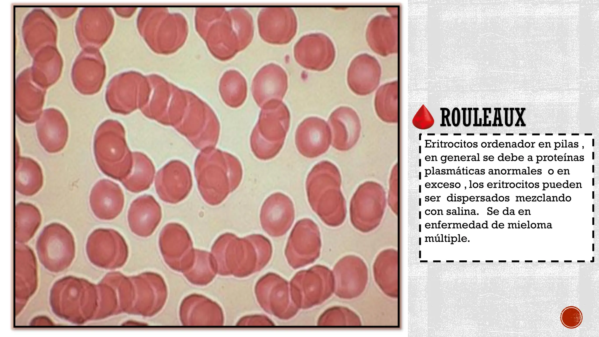 Patologías de los eritrocitos-Histologia.pptx | PDF