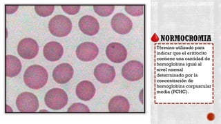 Patologías de los eritrocitos-Histologia.pptx | PDF