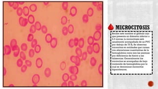 Patologías de los eritrocitos-Histologia.pptx | PDF