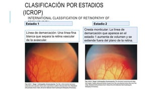 Patologias del prematuro | PPTX