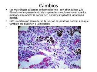 Patologías del pulmón | PPTX