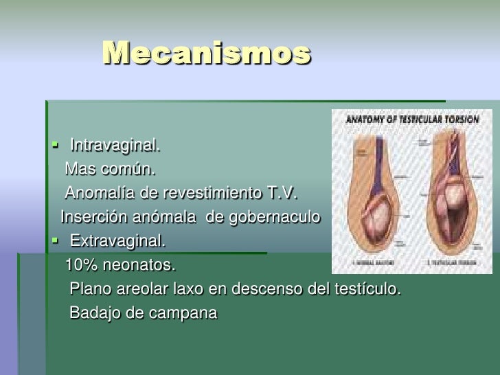 Patologias del testiculo