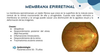EXPOSICION OFTALMOLOGIA PATOLOGIAS DE RETINA | PDF