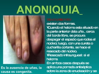 Patologias De UñAs Y Pies | PPT