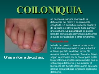 Patologias De UñAs Y Pies | PPT