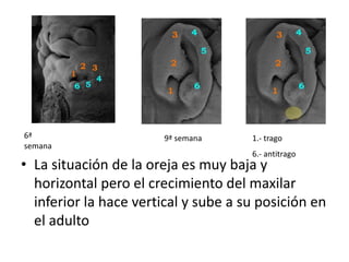 Patologias embriologicas de oido | PPTX