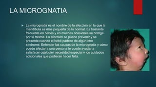 PATOLOGIAS EN EL TEJIDO OSEO EN EL MAXILAR-2.pptx
