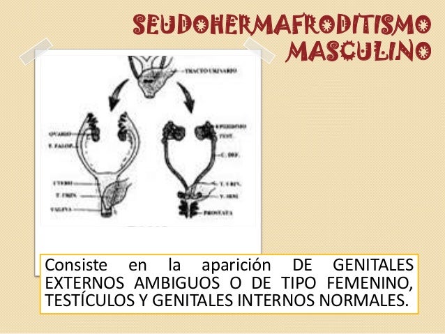 Patologia seudo hermafroditismo