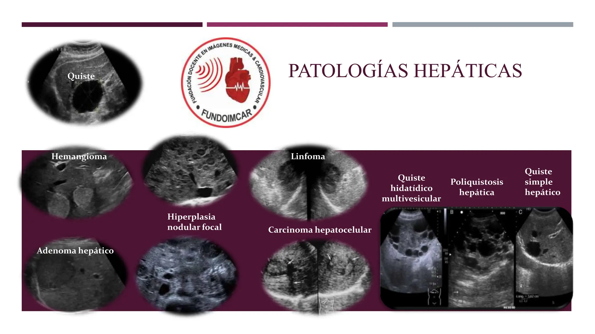 Patologías hepaticas.pptx Patologías hepaticas.pptx