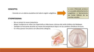 patologias inflamatorias de la laringe (1) (1)[1].pptx