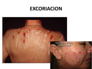Patologia Sistemica Piel Pptx