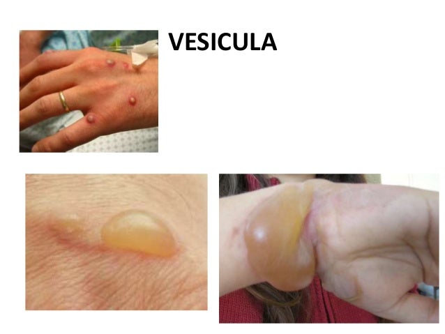 Patologia sistemica. PIEL