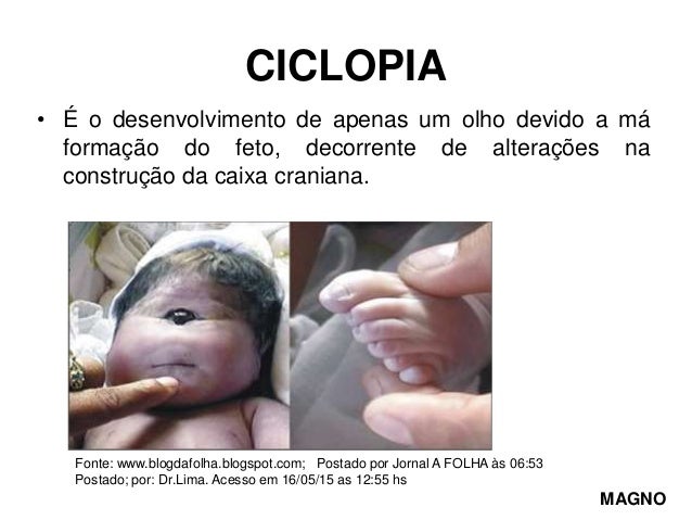 Patologia slide