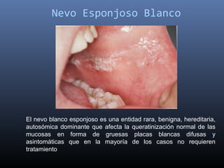 Patologias orales | PPT
