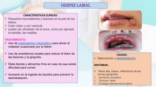 Patologias orales en niños odp | PPTX