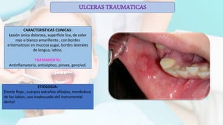Patologias orales en niños odp | PPTX