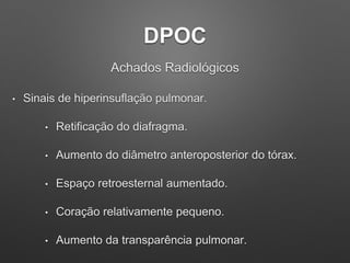 Monitoria Patologias Pulmonares na Radiografia Simples de Tórax | PPT