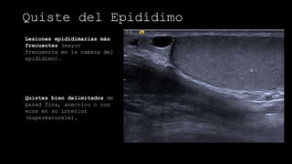 PATOLOGIA TESTICULAR POR DIAGNOSTICO POR IMAGENES.pptx