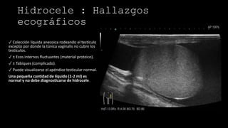 PATOLOGIA TESTICULAR POR DIAGNOSTICO POR IMAGENES.pptx