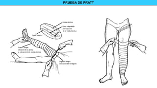 Patologia venosa de miembros inferiores | PPT