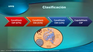 Patologia Vestibular Periférica Endolaberintica | PPTX