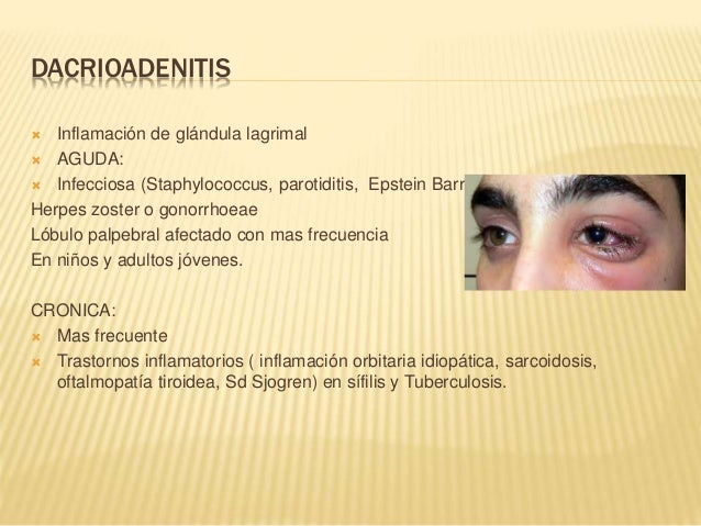 Patologia via lagrimal