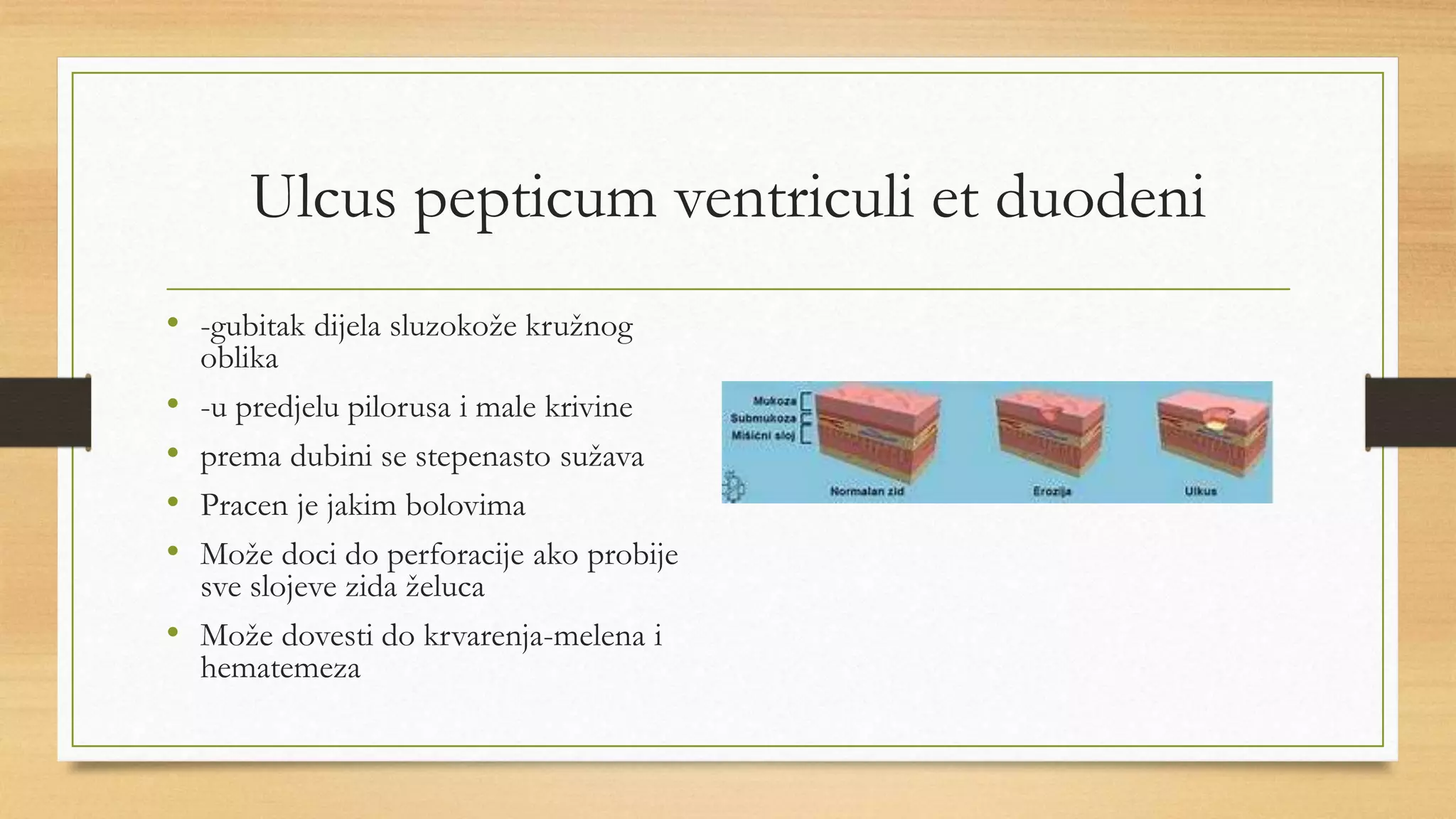Patologija digestivnog sistema | PPTX