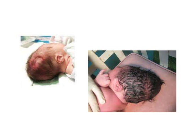 Patologija neonatalnog perioda | PPT