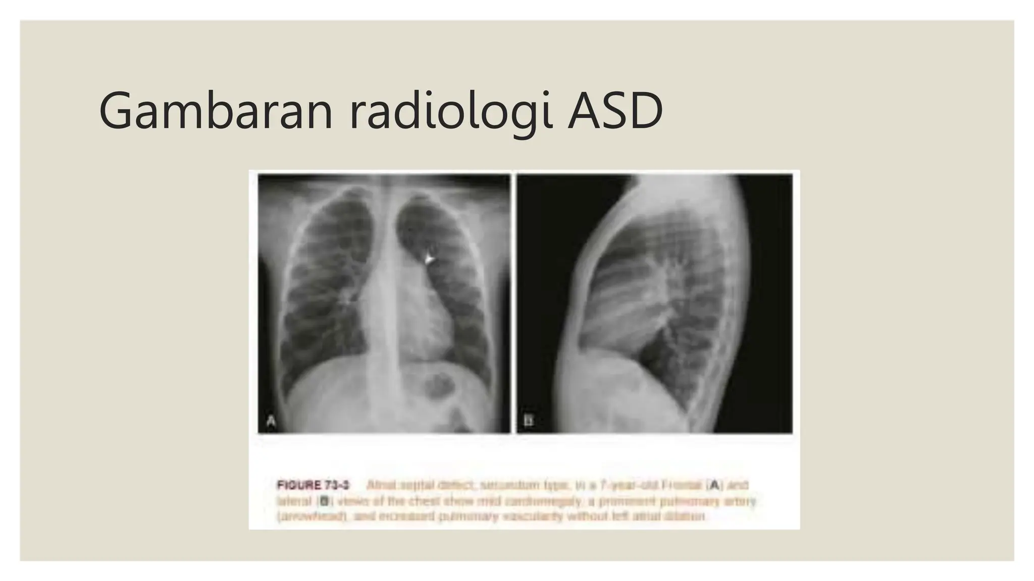 patologi sistem kardiovaskular.pptx