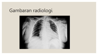patologi sistem kardiovaskular.pptx