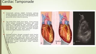 Patologi sistem respiratorik dan kardiovaskular | PPTX